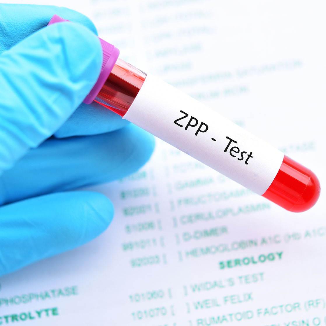 Porphyrin versus Pyrrole Testing. Is there a Difference? - Annalies ...